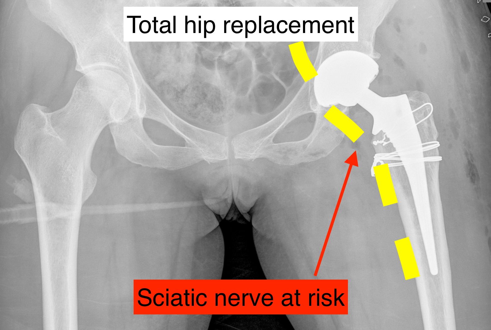 Nerve Injury After Undergoing Surgery nerve-injury-after-undergoing-surgery
